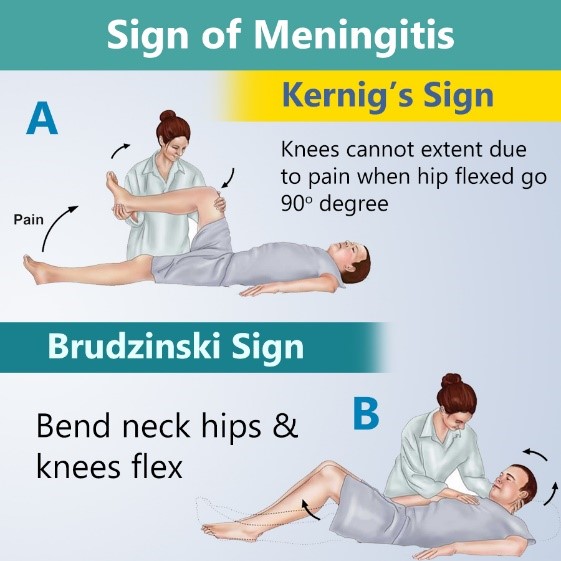 Neurological System NCLEX Review | Medcrine