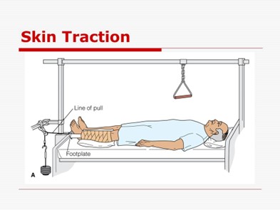 Musculoskeletal System NCLEX Review | Medcrine